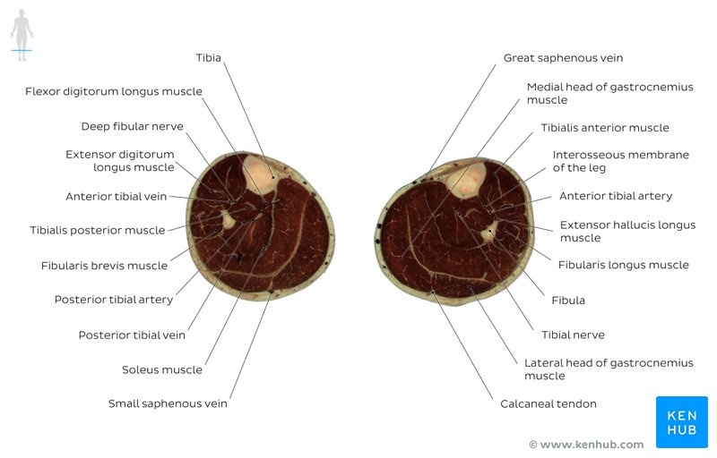 Cross sectional anatomy | Kenhub