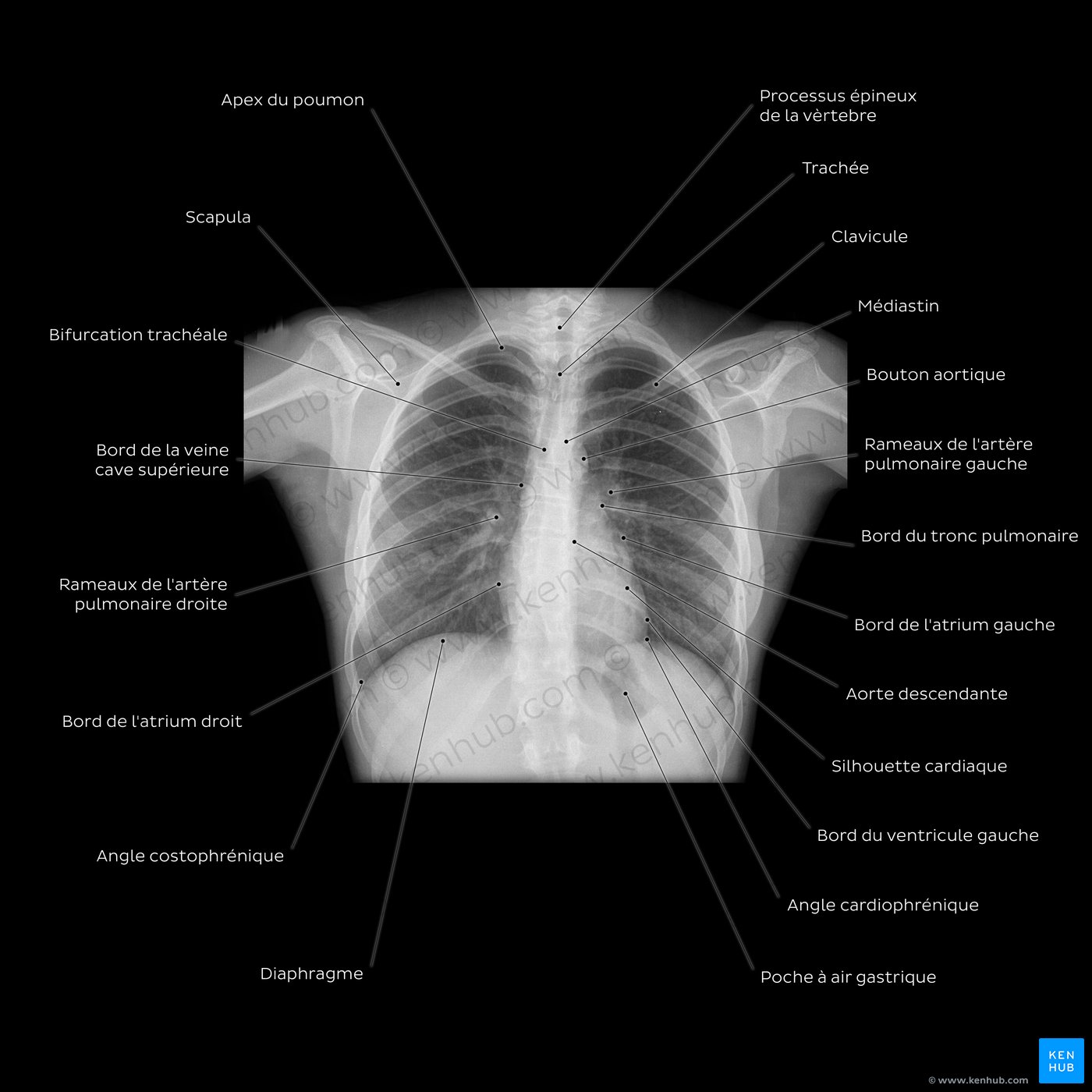 Anatomie radiologique : Radiographie, TDM, IRM | Kenhub