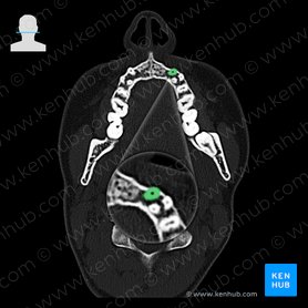 Canine tooth: anatomy, location and function | Kenhub