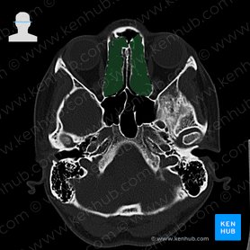 Paranasal sinuses: Anatomy, structure and functions | Kenhub