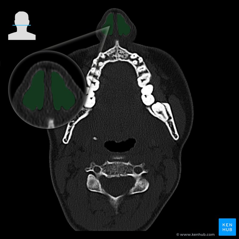 Fosas nasales: Anatomía y ubicación | Kenhub