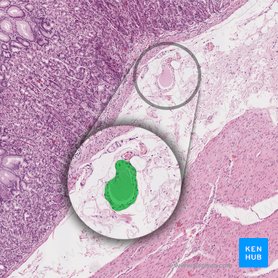 Lymphsystem - Aufbau, Organisation, Elephantiasis | Kenhub