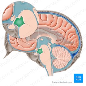 Ventricles of the brain: Anatomy and pathology | Kenhub