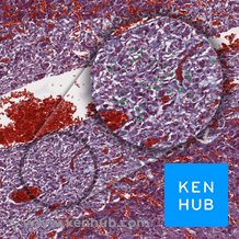 Chromaffin cells: Anatomy and function | Kenhub