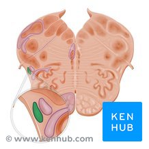 spinocerebellar tract lesion
