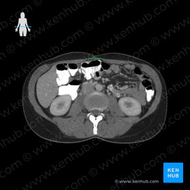 Linea alba: Attachments, relations and function | Kenhub