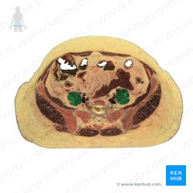 Musculus psoas major: Anatomie, Funktion und Klinik | Kenhub