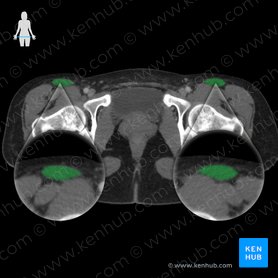 Sartorius muscle: Anatomy, attachments, function | Kenhub