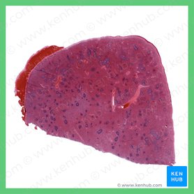 Spleen: Anatomy, location and functions | Kenhub