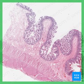 Jejunum (Leerdarm): Anatomie, Histologie, Funktion | Kenhub