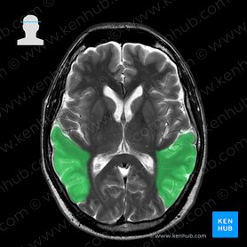 Brain MRI: How to read MRI brain scan | Kenhub