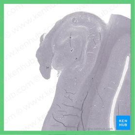 Hippocampus: Anatomy, functions and connections | Kenhub