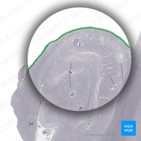 Fornix of the brain: Anatomy and functions | Kenhub