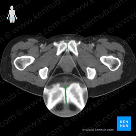 Pubic symphysis: Anatomy, structure and function | Kenhub