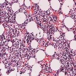 Red bone marrow: Histology and function | Kenhub
