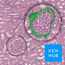Glomerular capsule: Anatomy and function | Kenhub