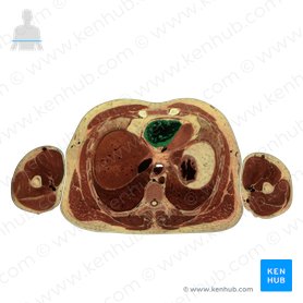 Ventrículos do coração: anatomia, função, características | Kenhub