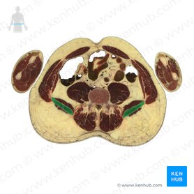 Ilium: anatomy and function | Kenhub