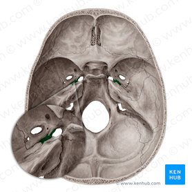 Temporal bone: Anatomy, parts, sutures and foramina | Kenhub