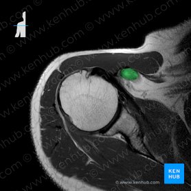Coracoid process: Anatomy, attachments and location | Kenhub