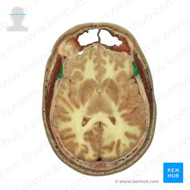 Schnittbildanatomie des Menschen | Kenhub