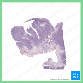 Tonsillen (Mandeln) - Histologie und Klinik | Kenhub