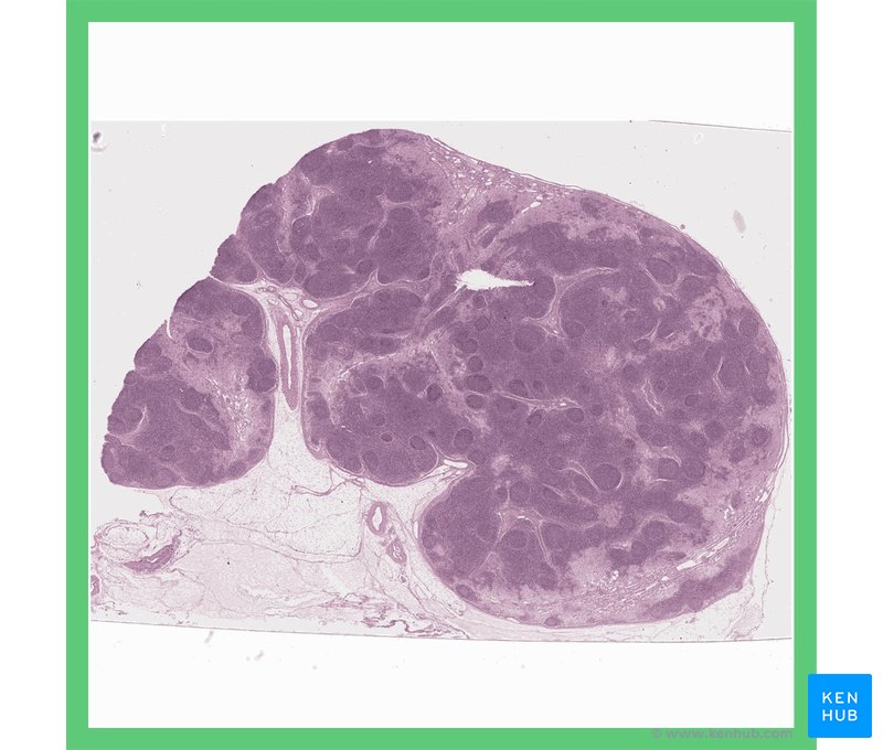 lymph node slide under microscope