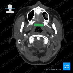 Palato Mole: Anatomia, função, musculatura e patologias | Kenhub