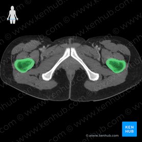 Femur (Oberschenkelknochen) - Anatomie, Aufbau und Bänder | Kenhub