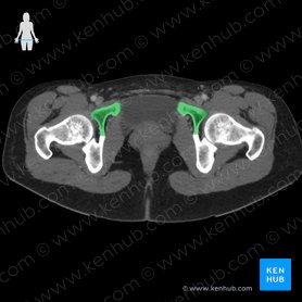 Pubis: anatomy and function | Kenhub