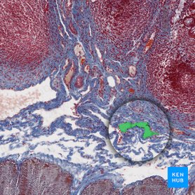 Lymphatic system: Definition, anatomy, functions | Kenhub