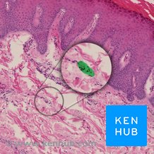 Ruffini corpuscle: Anatomy, location and function | Kenhub