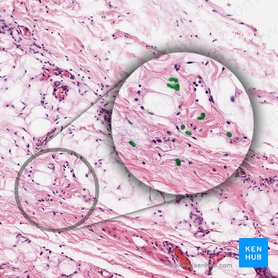 Fibroblast: Histological structure and function | Kenhub