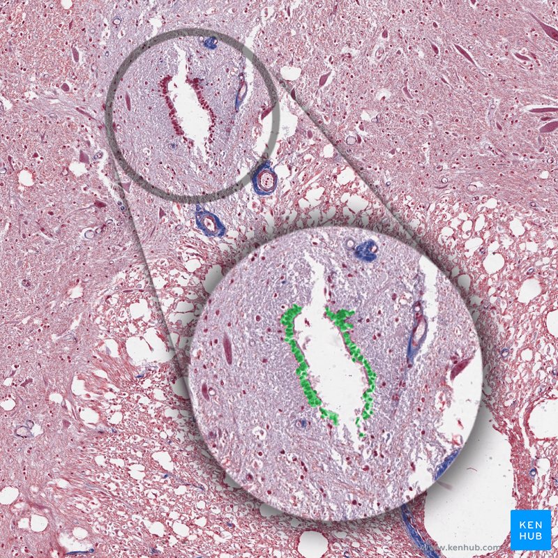 Ependymal cells: Histology and function | Kenhub