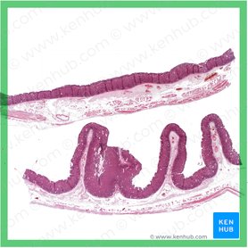Fundus gastricus: anatomy and function | Kenhub