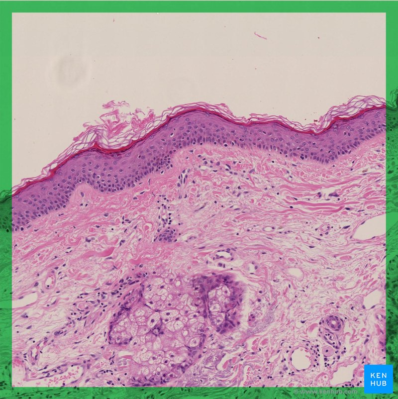 thick skin histology diagram